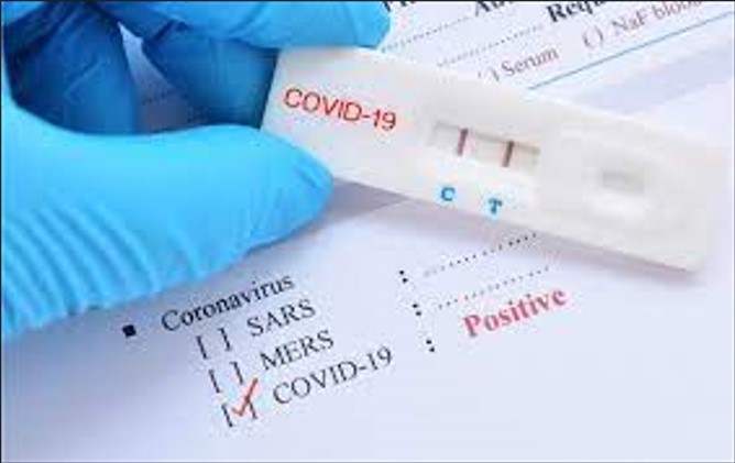 ΕΠΕΙΓΟΝ: Στην απόφαση ΑΠΑΓΟΡΕΥΣΗΣ rapid test από τον Ε.Ο.Φ αναγράφεται ...